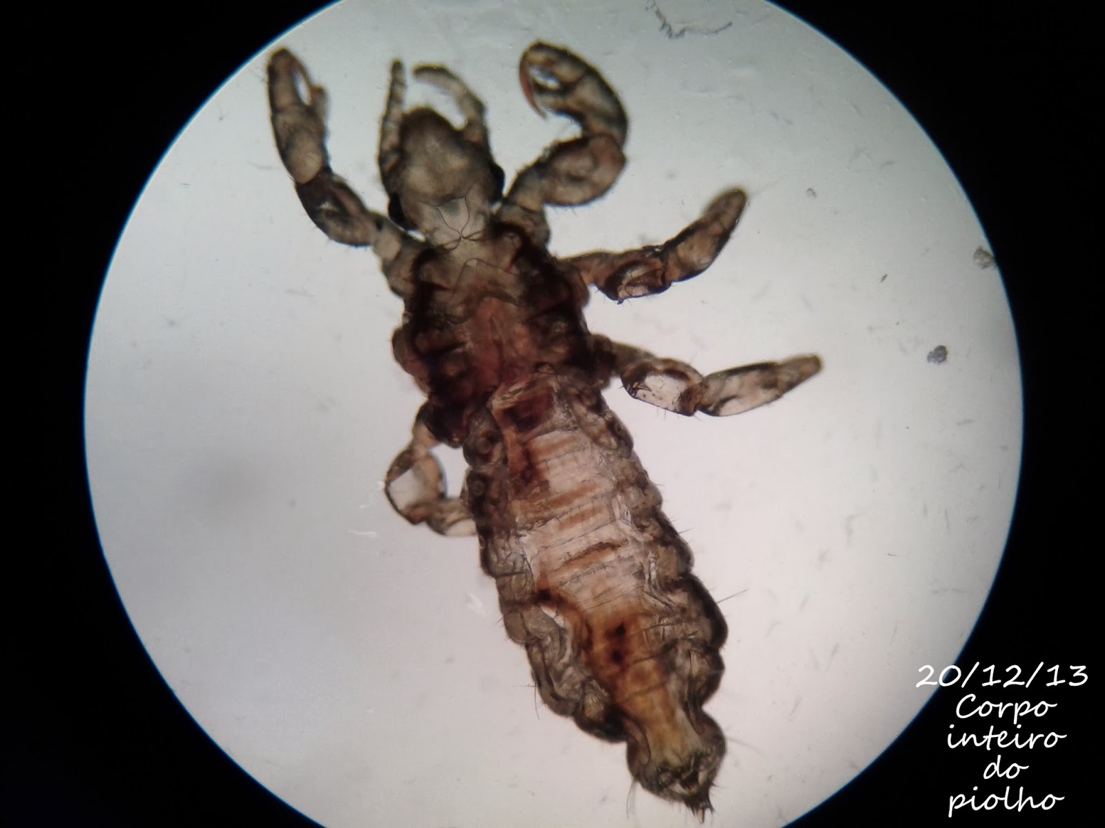 Piolhos: Imagens e vídeos no microscópio - Diário de um Cientista