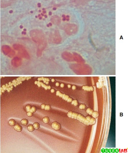 [Microbiology] Atlas of Neisseria Species and Moraxella catarrhalis ...