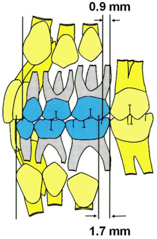 INOBI: ¿COMO GANAR ESPACIO EN ORTODONCIA?