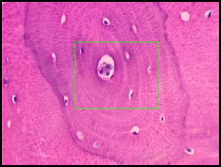 Morfofisiologia - Osteologia: TEJIDO ÓSEO