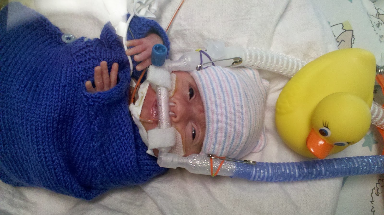 JAM sessions: Lessons learned through a micro-preemie: Week 32 ...