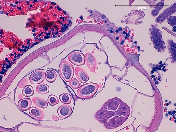 Fun With Microbiology (What's Buggin' You?): Enterobius vermicularis ...