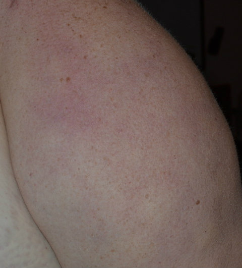 Fingers and Toads: Who needs ASSISTANCE!!!!!