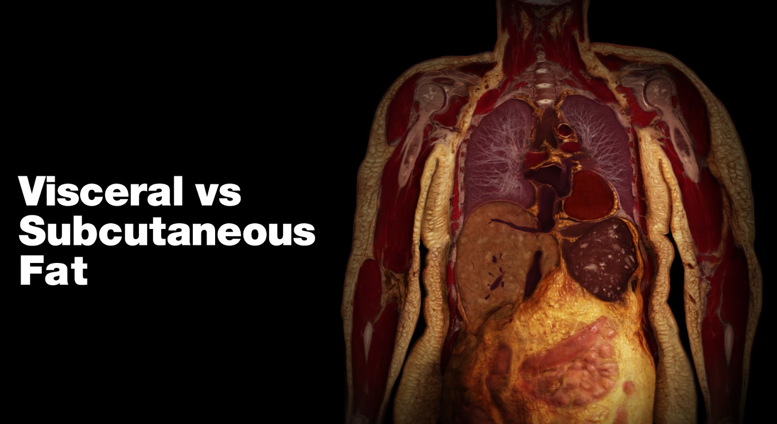 เรื่องพยายามสวย ของชิกเก้นรัน,, How to be a beautiful chubby gril ...