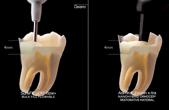 DENTAL MATERIALS: Composite Competitive Comparison: SureFil® SDR® flow+ ...