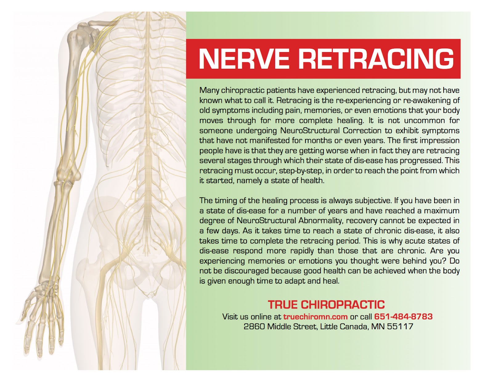 True ChiropracTIC: Nerve Retracing