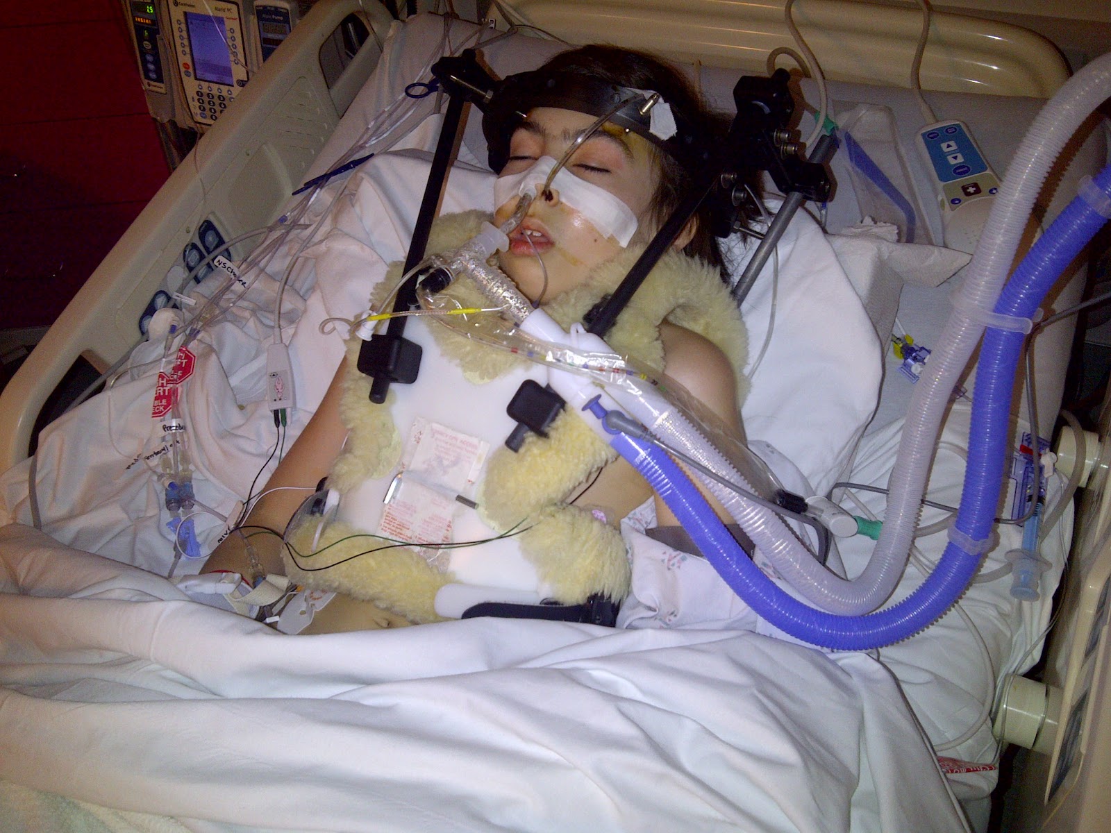 Kyle's Chiari Malformation Battle