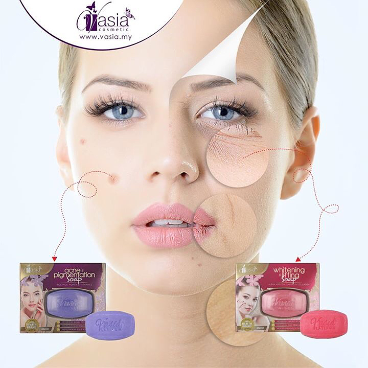 ACNE & PIGMENTATION SOAP V'ASIA | BEAUTY KIOSK