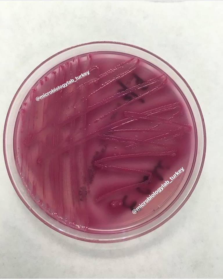 MacConkey Agar - Microbiology Laboratory Turkey