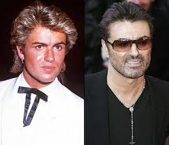George Michael Plastic Surgery Before and After Browlift ...