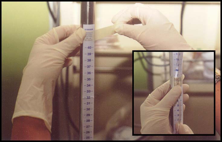 Enfermagem a arte de cuidar: PRESSÃO VENOSA CENTRAL(PVC)