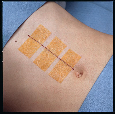 Modern First Aid: Work Cited