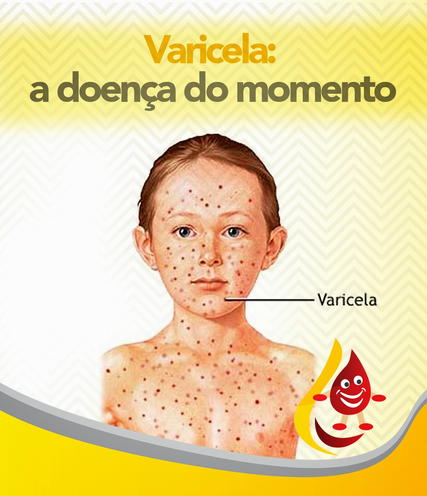 Pediatra Julie Anne Colnago: Varicela: a doença do momento