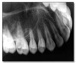 Dentistry and Medicine: Intraoral Radiographic Techniques (Intraoral ...
