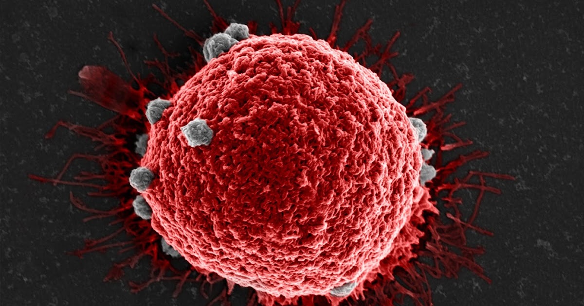 career: A new weapon for the war on cancer 07-14