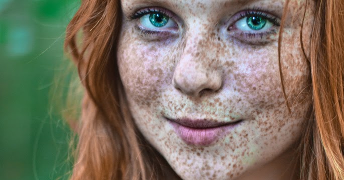 A View from the Beach: Beware of the Hidden Ginger Gene!