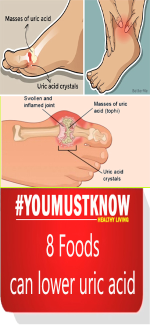 8 Foods can lower uric acid - nutrition health