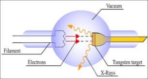 Image Processing - Image sources: X-ray Imaging