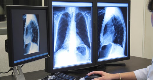 Warungbocah7: Mengenal Alat Kesehatan Radiologi