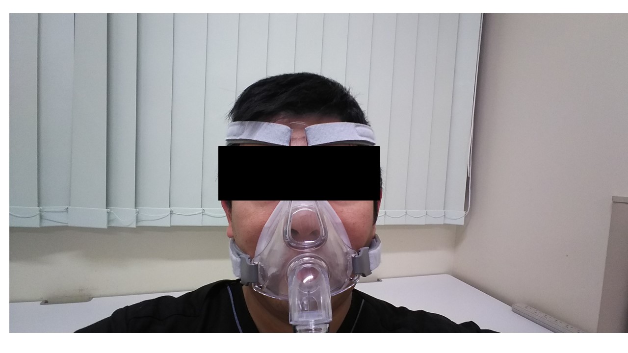 F&PのNPPV用マスク Nivairo（ニヴァイロ）を使ってみた-臨床工学技士による呼吸療法勉強会