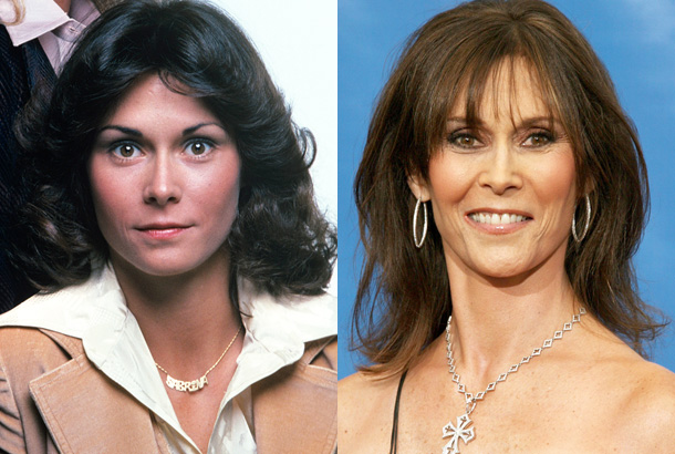 Kate Jackson Plastic Surgery