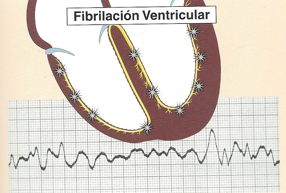 Dr. Rafael Soto - Electrocardiografía - Cardiología clínica ...