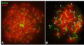 Inmunofluorescencia | Morfocitos