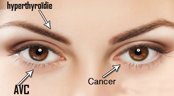 8 choses que vos yeux peuvent vous dire sur votre santé - Hors de vos ...