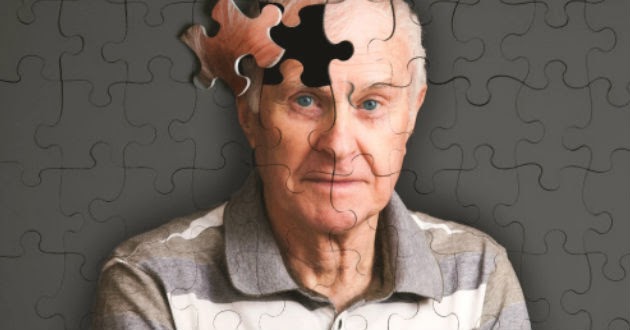 Enfermedad de Alzheimer: Deterioro Cognitivo Leve: Criterios diagnósticos