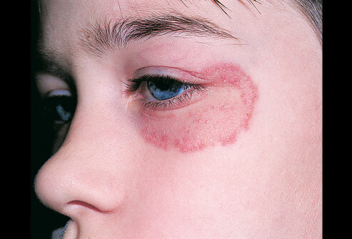 AMAZING BENEFITS OF LOTUS FOR SKIN,HAIR AND HEALTH - Herbal Skill Care