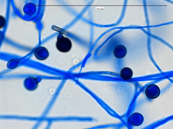 Fun With Microbiology (What's Buggin' You?)