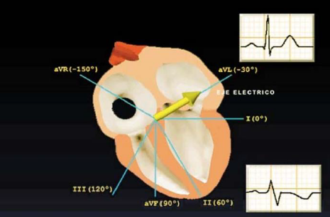 eje electrico corazon