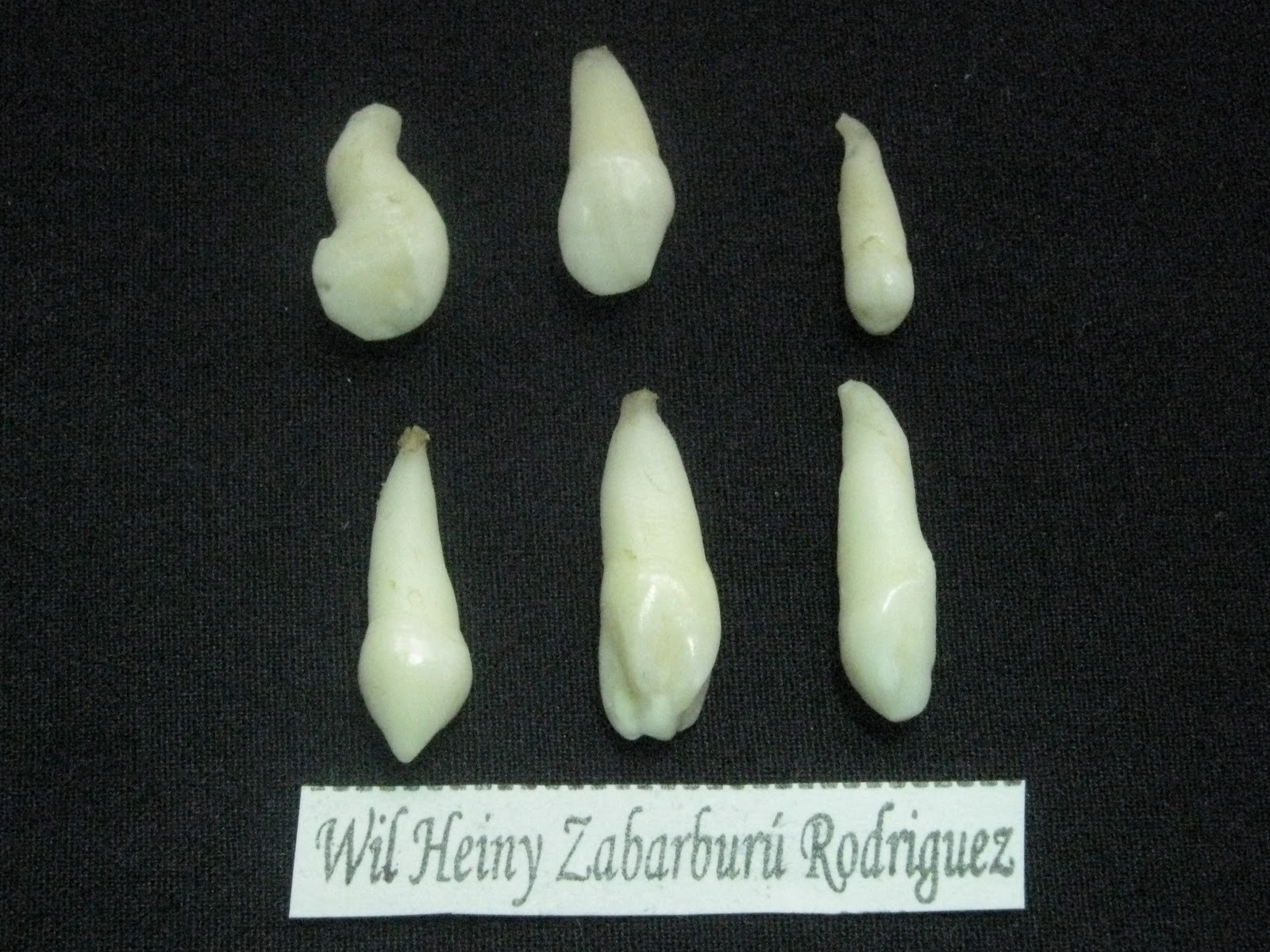 CLINICA DENTAL ASISTENCIAL: ANATOMÍA DENTARIA, MESIODENS