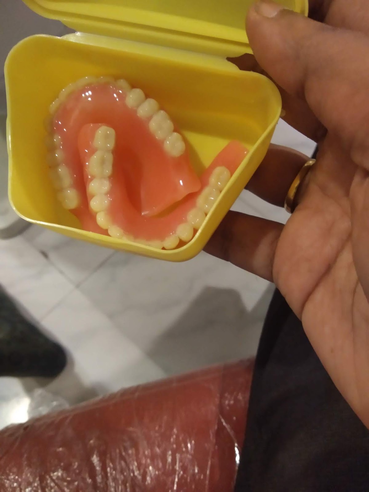 Dencity dental care: BPS COMPLETE DENTURE