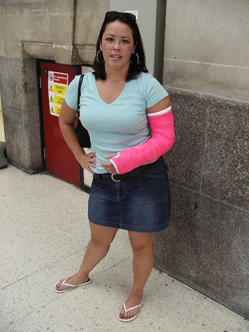 Casts & Lifestyle : Curvy in long arm cast