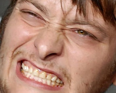 New Celebrity Buzz: Edward Furlong Teeth