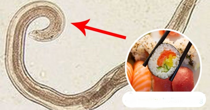 7 Early Warning Signs You Have A Worm In Your Brain From Eating Sushi ...