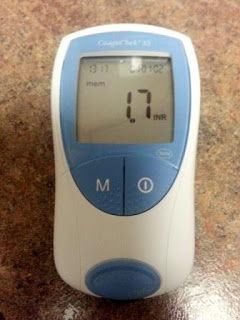 Cruising Past Seventy: FALLING ILL WHEN YOU LEAST EXPECT IT...WHEN YOU ...