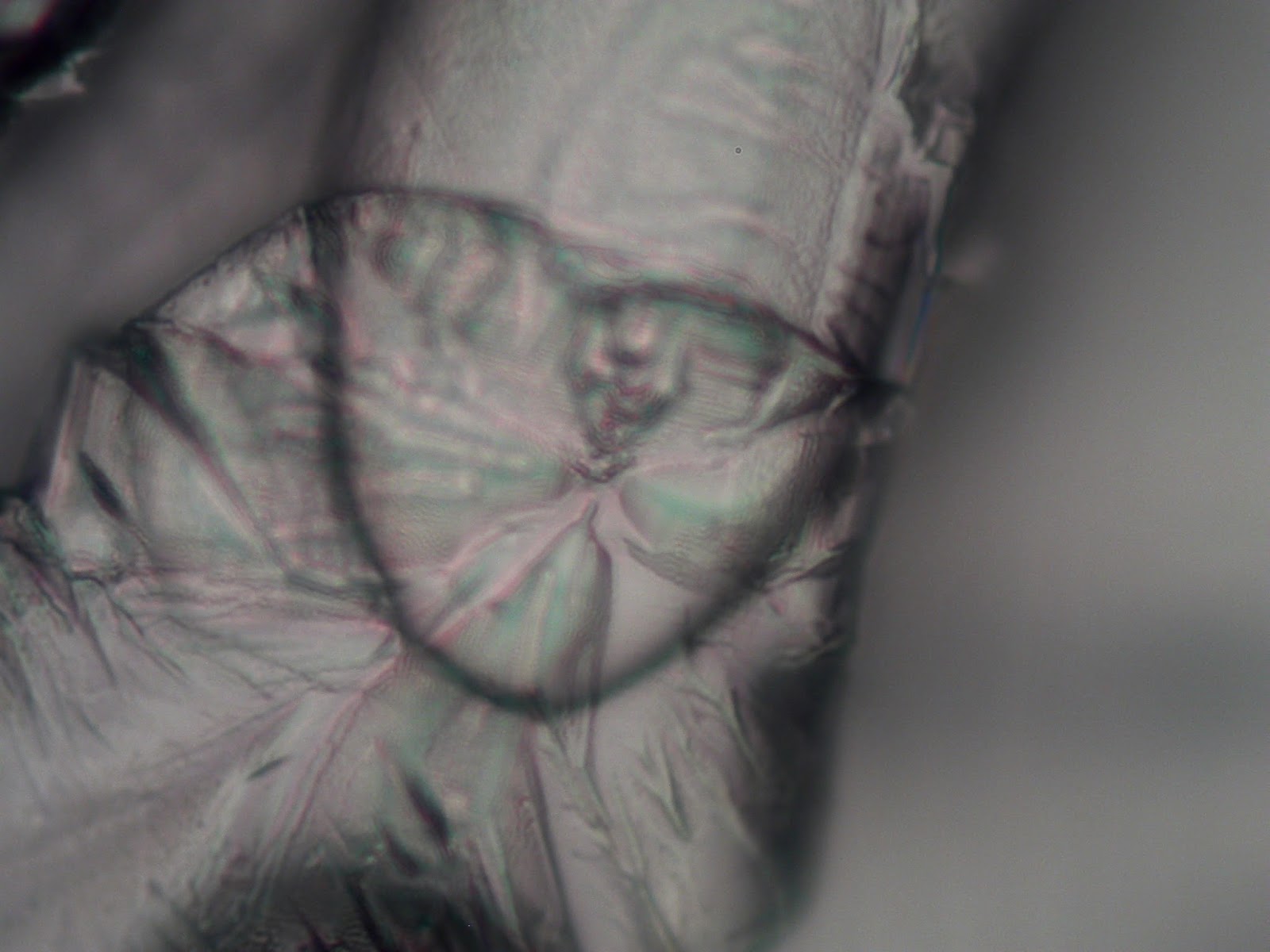 Micro-World: The beauty of a dried tear