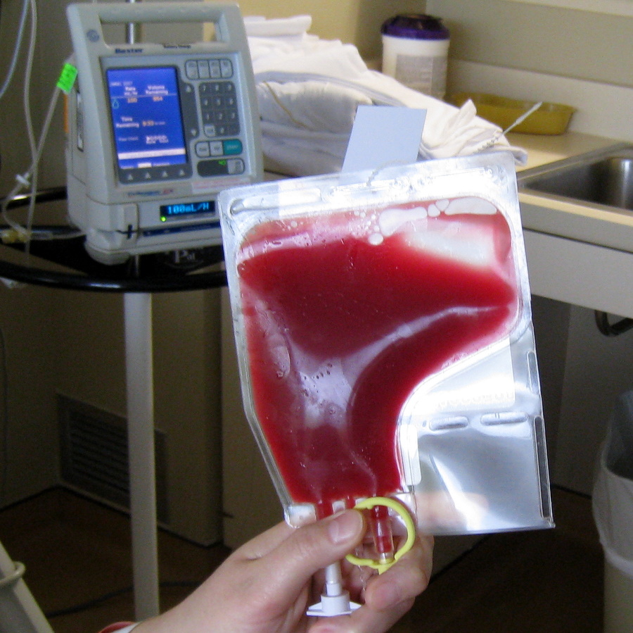 For the love of : The Stem Cell Transplant in a very simple NutShell