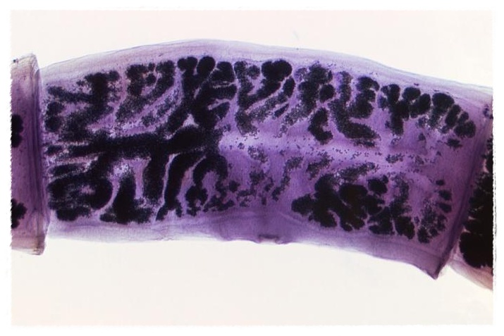Gambar Macam-macam cacing | Dunia Binatang