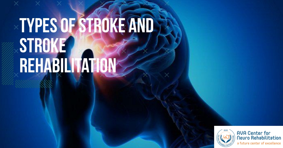 Types of Stroke and Stroke Rehabilitation
