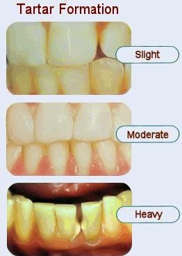 Omni Dental Group: Give Yourself A 60-Second Dental Check-Up