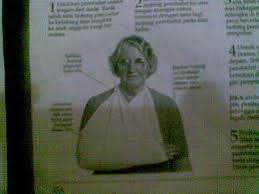 materi p3k: cara membalut luka