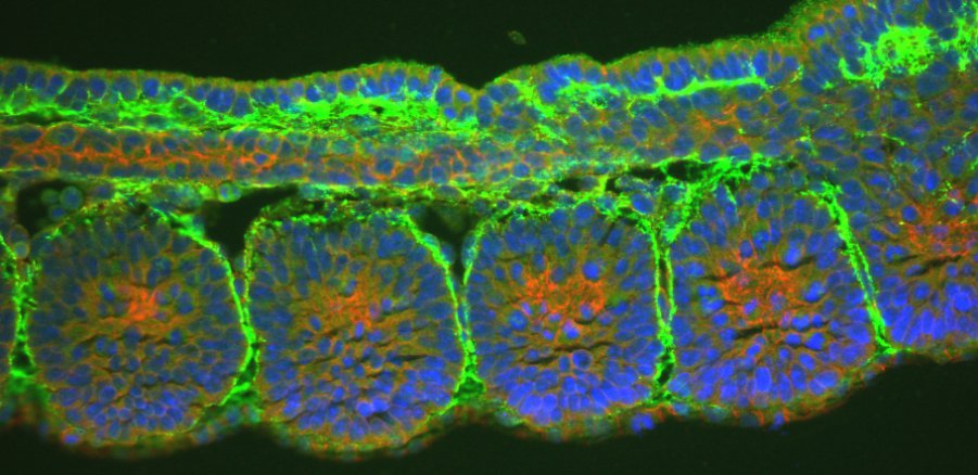 La adhesión celular - Biología