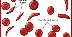 Genetika, Sub Bab Gen Letal, Alel Ganda, dan Alel Kodominan - Biologi ...