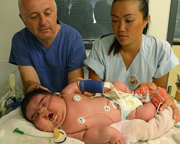 Bayi Raksasa Seberat 6 Kg Dilahirkan di Jerman