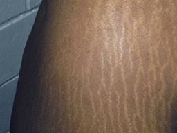 Simple Beauty tips: Simple skin care tips (Useful beauty tips)