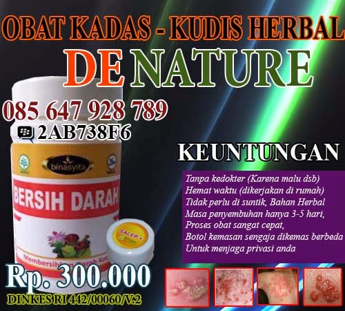 cara mengobati kadas pada kulit bayi | Obat Kadas Ampuh