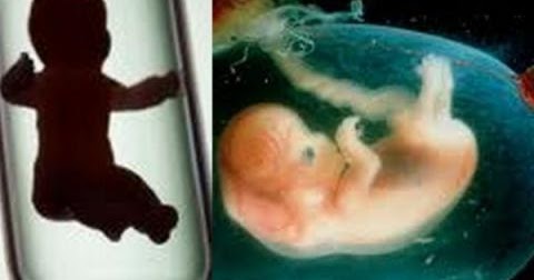 10 Tahapan Proses Pembuatan Bayi Tabung ~ PERAWAT HEBAT KELSA